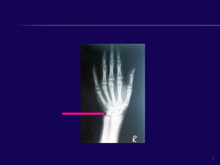 X-ray identification of bones for forensic | PDF