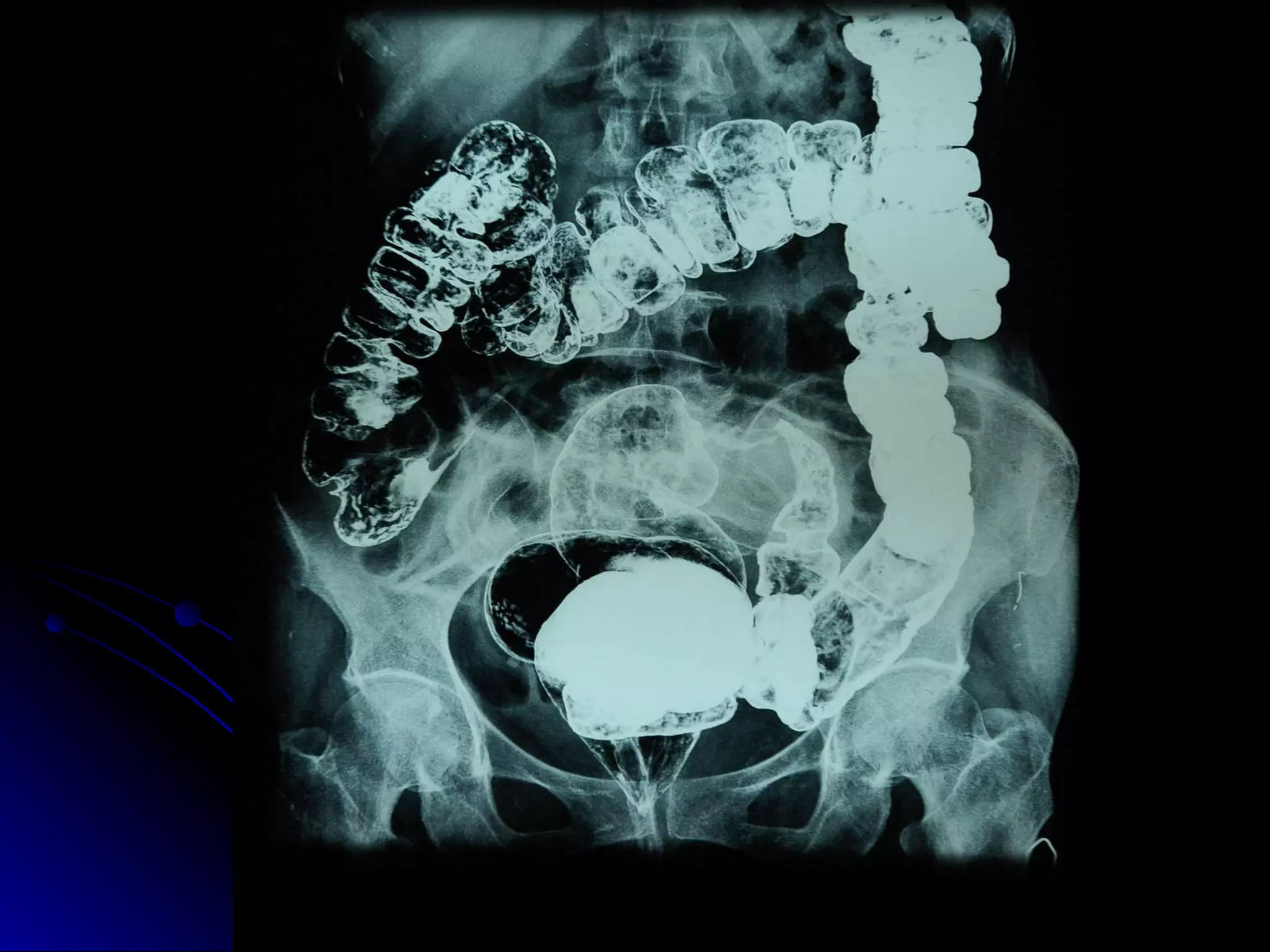 Surgery X-rays | PPT