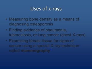 xrays basics.ppt