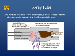 xrays basics.ppt