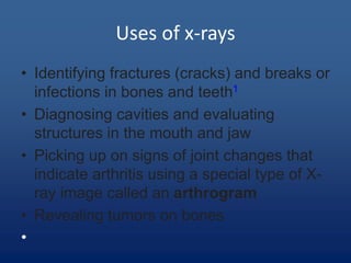 xrays basics.ppt