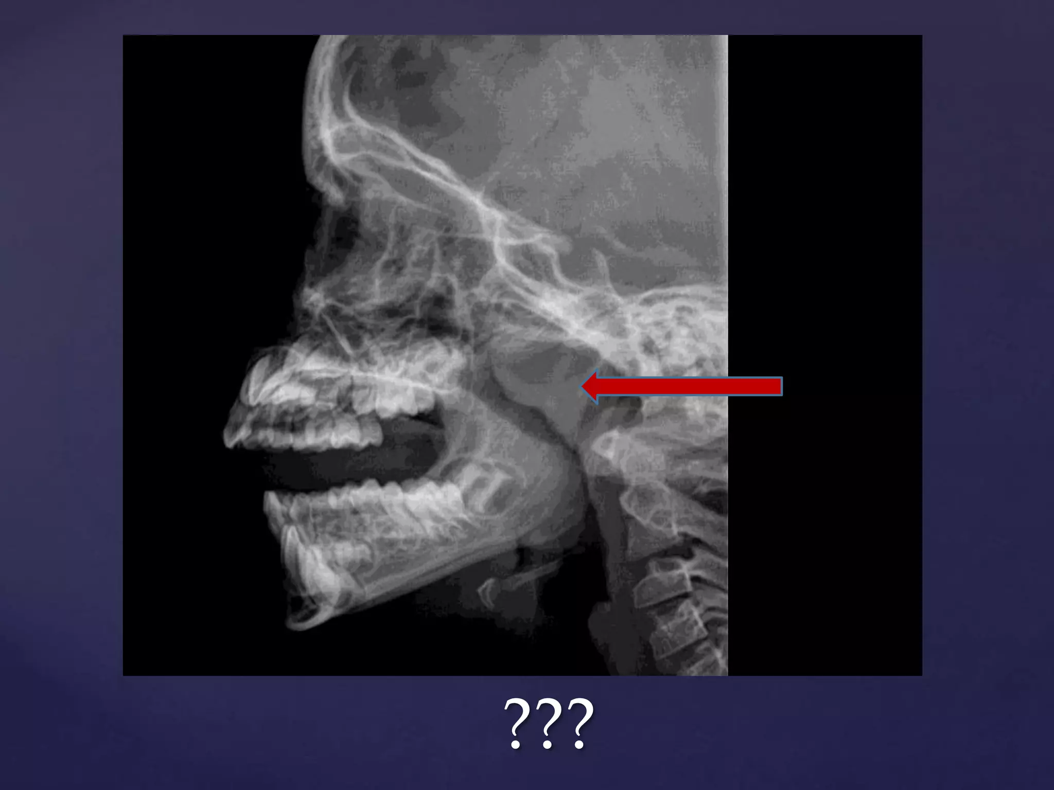 X rays in ent | PPTX