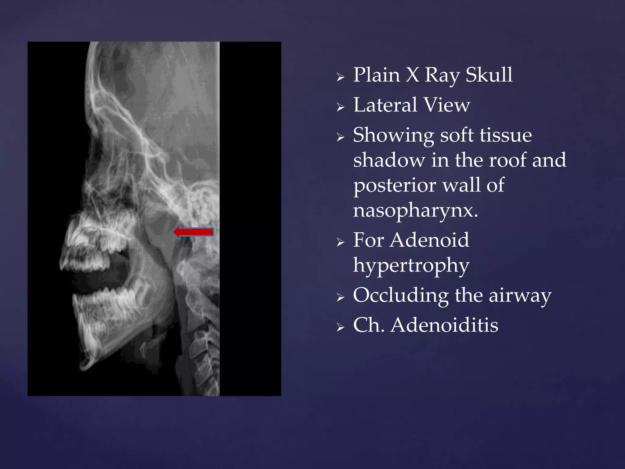 X rays in ent | PPTX