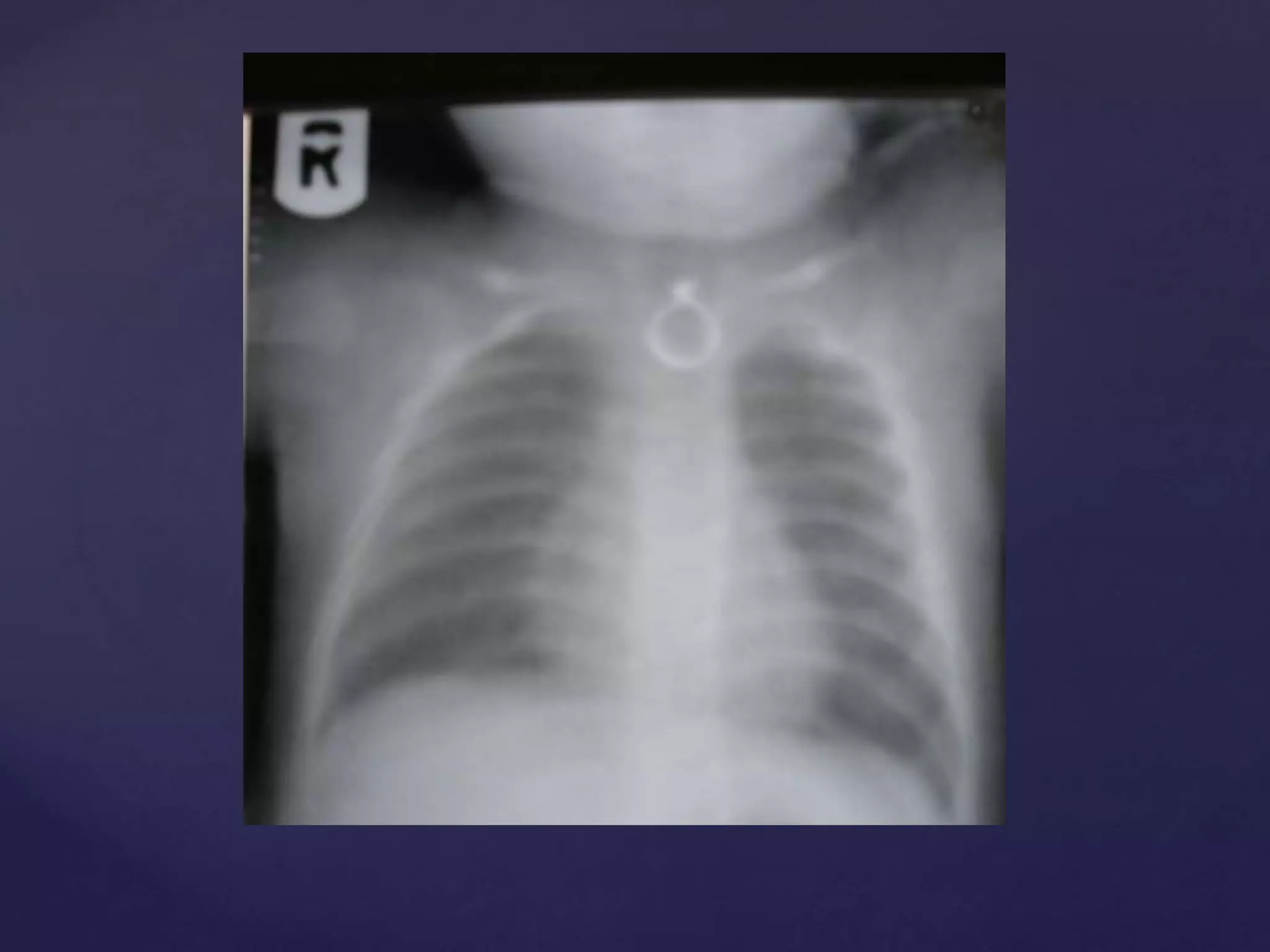 X rays in ent | PPTX