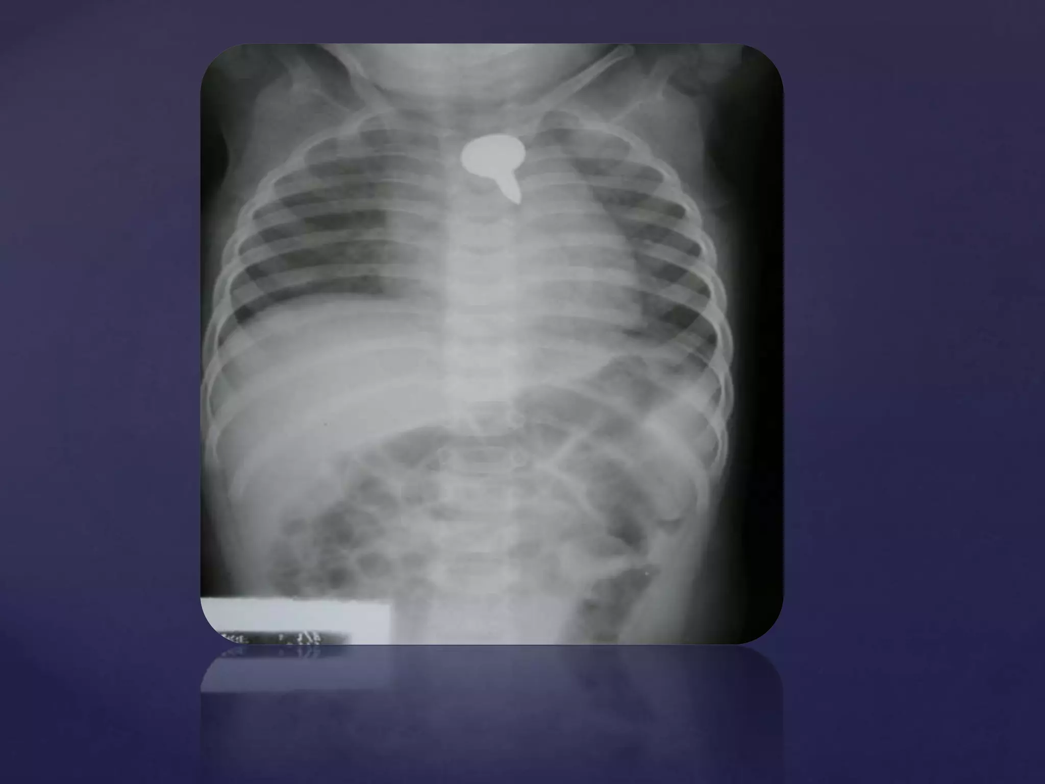 X rays in ent | PPTX