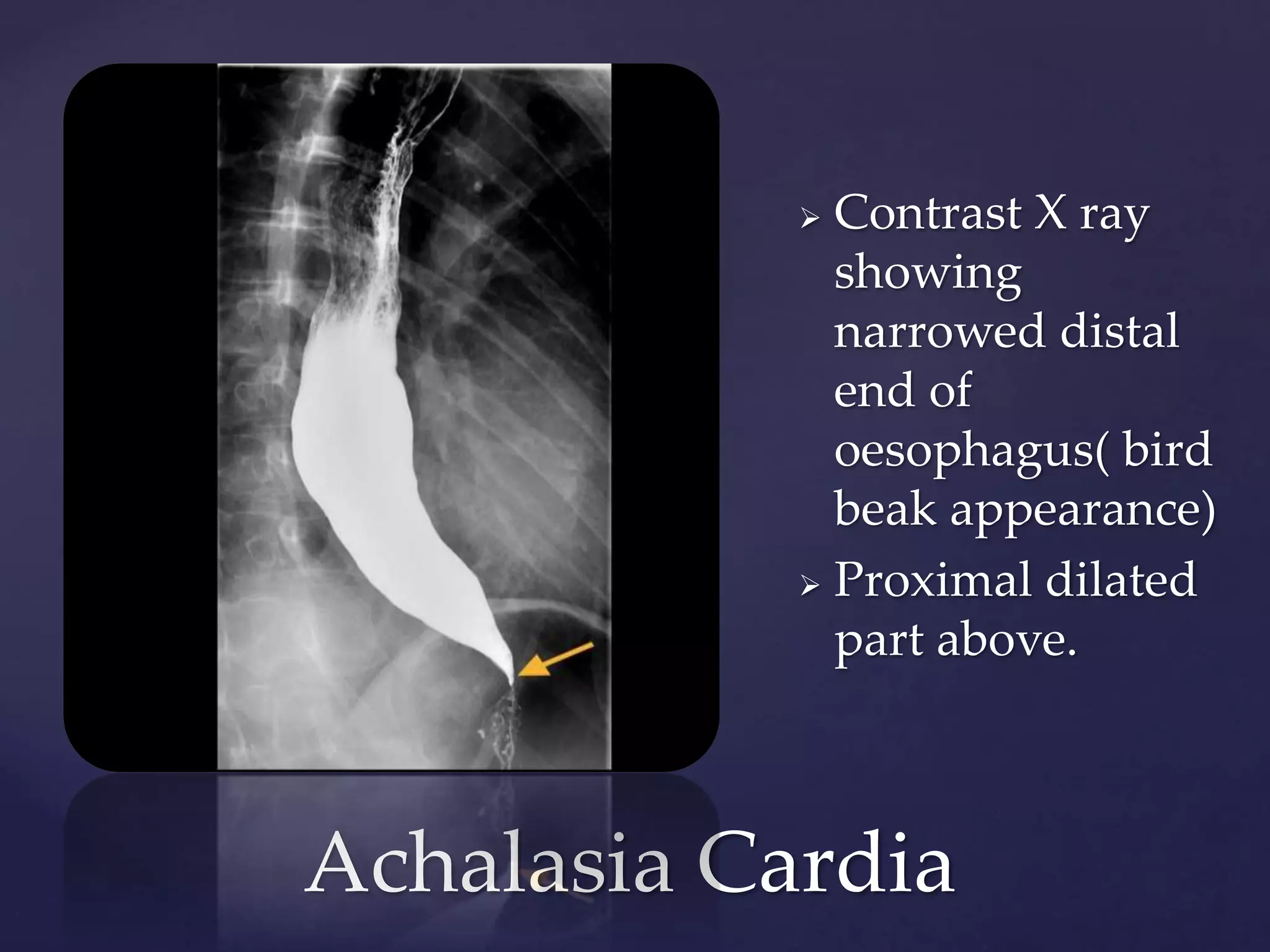 X rays in ent | PPTX