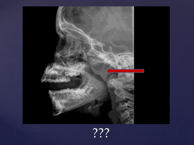 X rays in ent | PPTX | Ear, Nose and Throat Conditions | Diseases and Conditions
