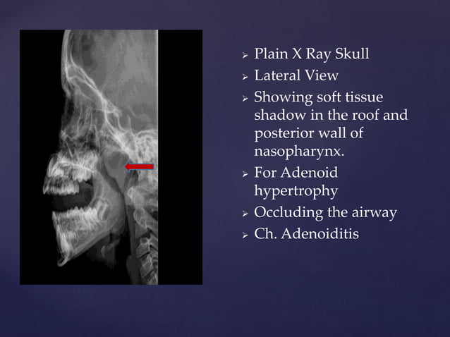 X rays in ent | PPTX | Ear, Nose and Throat Conditions | Diseases and Conditions