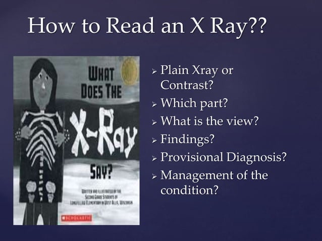X rays in ent | PPTX | Ear, Nose and Throat Conditions | Diseases and Conditions
