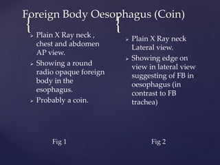X rays in ent | PPTX