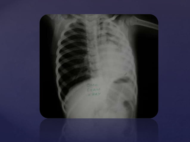 X rays in ent | PPTX | Ear, Nose and Throat Conditions | Diseases and Conditions