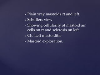 X rays in ent | PPTX