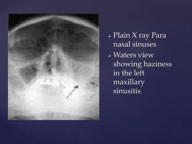 X rays in ent | PPTX | Ear, Nose and Throat Conditions | Diseases and Conditions