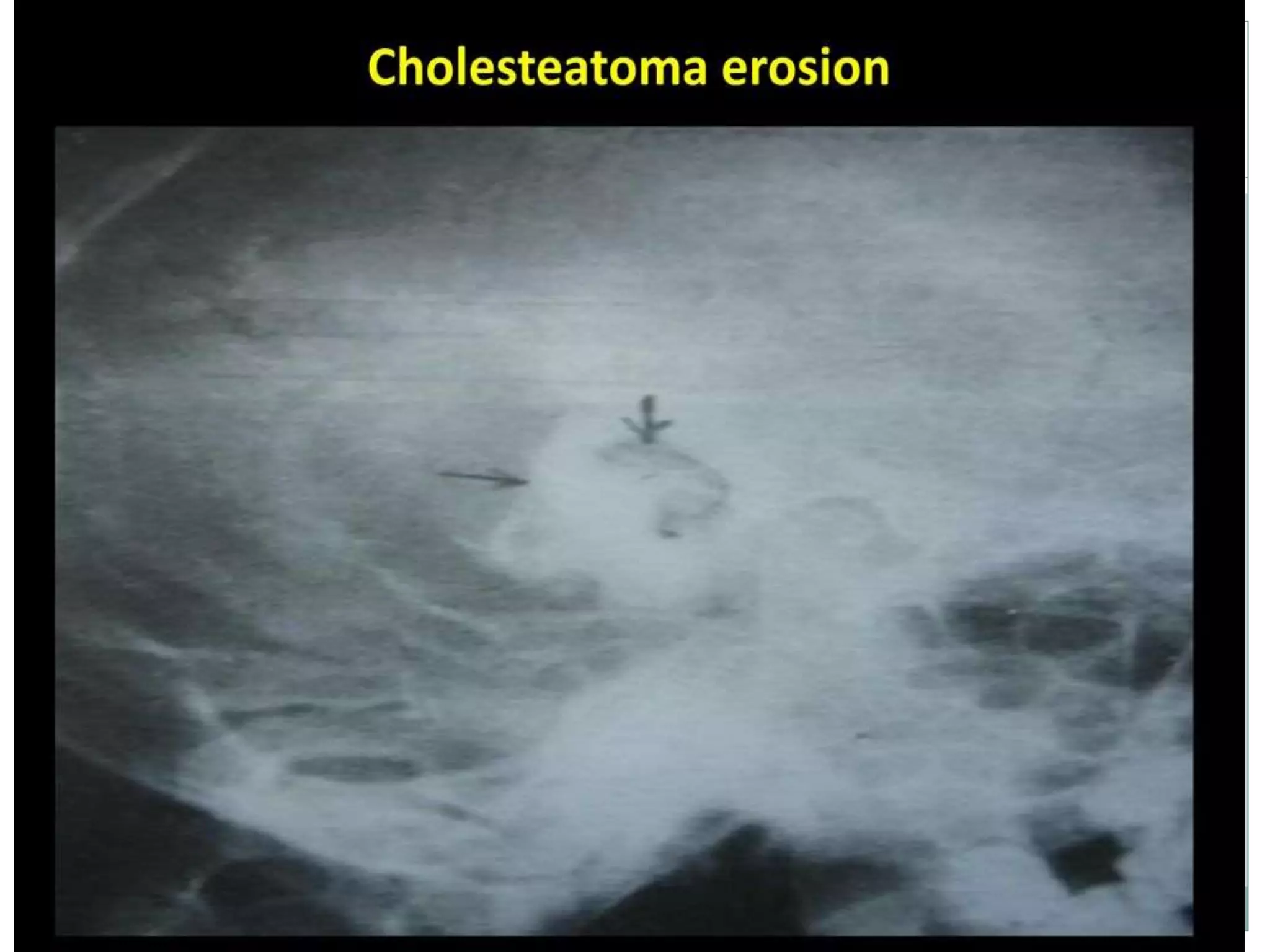 Xrays in ent- Dr Ashly Alexander | PPTX