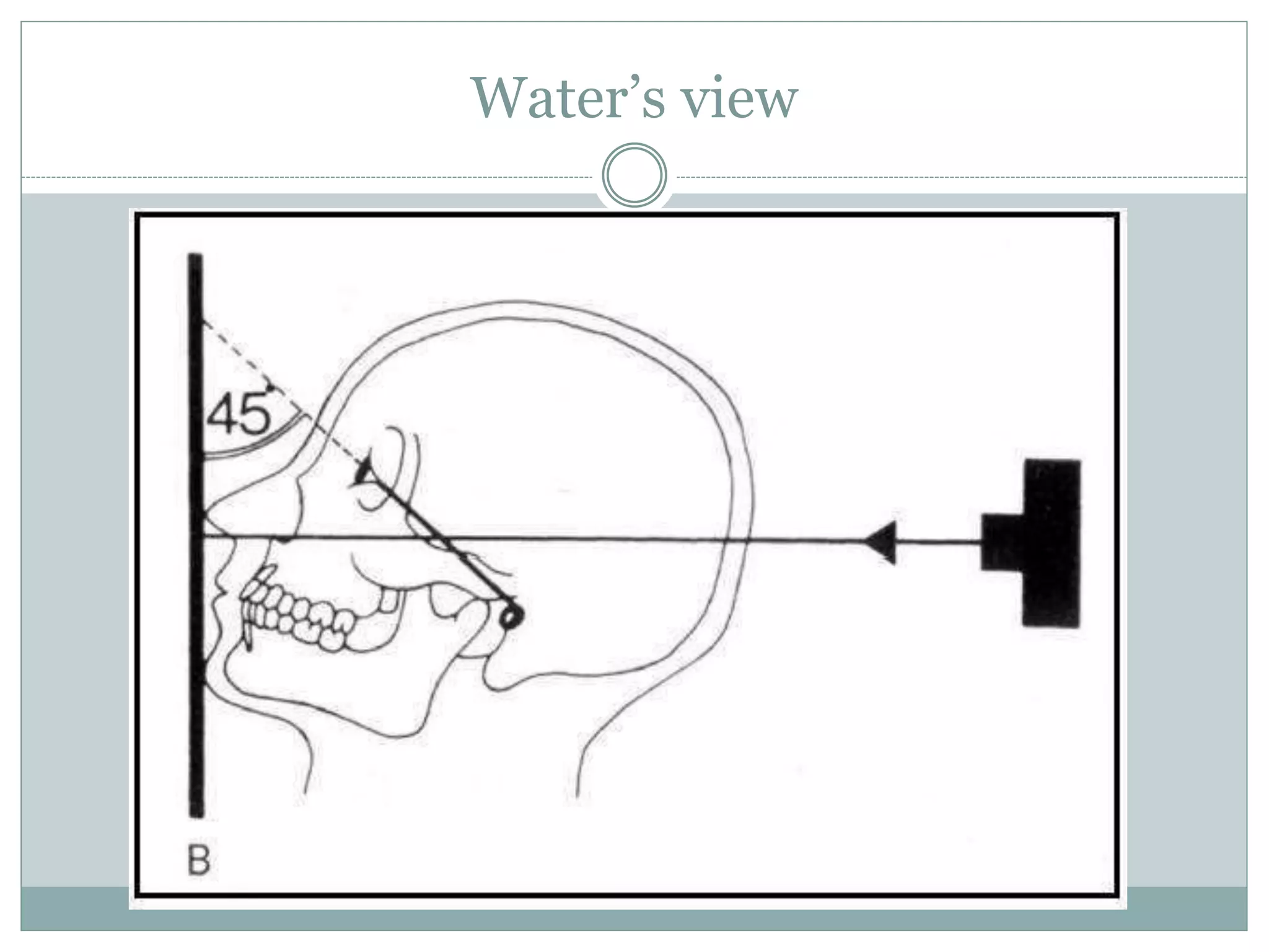 Xrays in ent- Dr Ashly Alexander | PPTX