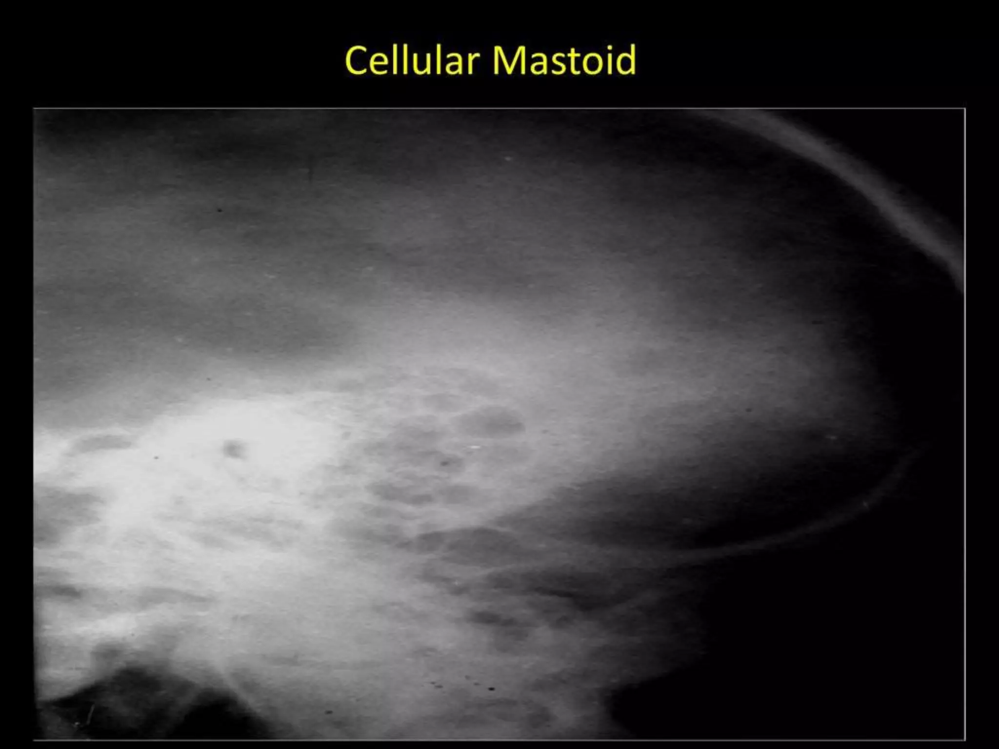 Xrays in ent- Dr Ashly Alexander | PPTX