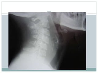 Xrays in ent- Dr Ashly Alexander | PPTX