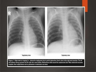Xrays in ent- Dr Ashly Alexander | PPTX
