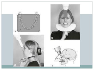 Xrays in ent- Dr Ashly Alexander | PPTX