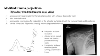 Xrays in Upper and lower limb Joints.pptx