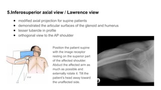 Xrays in Upper and lower limb Joints.pptx