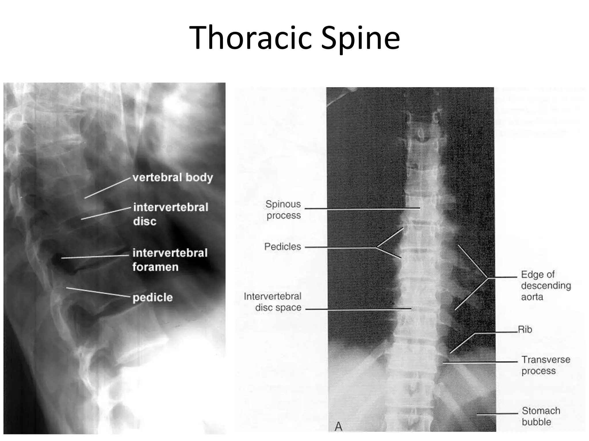 X_RAY_SPINE.pptx