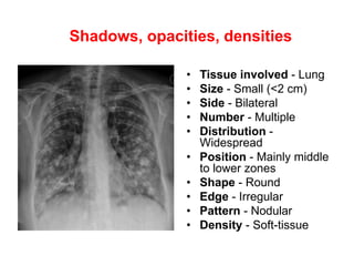 CHEST XRAYS SYSTEMATIC APPROACH,,,,,,,,, | PPTX | Lung and Respiratory ...