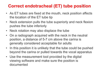CHEST XRAY TUBES.pptx,,,,,,,,,,,,,,,,,,, | PPTX