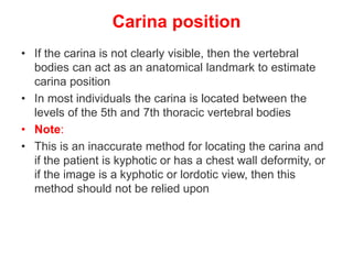 CHEST XRAY TUBES.pptx,,,,,,,,,,,,,,,,,,, | PPTX