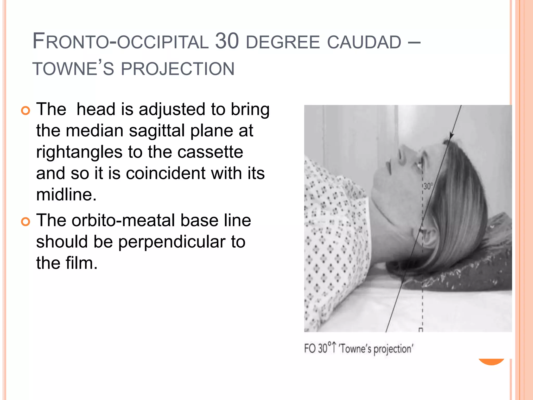 Xray views of skull1 | PPTX