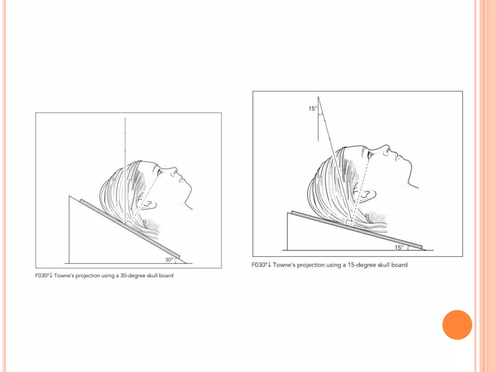 Xray views of skull1 | PPTX