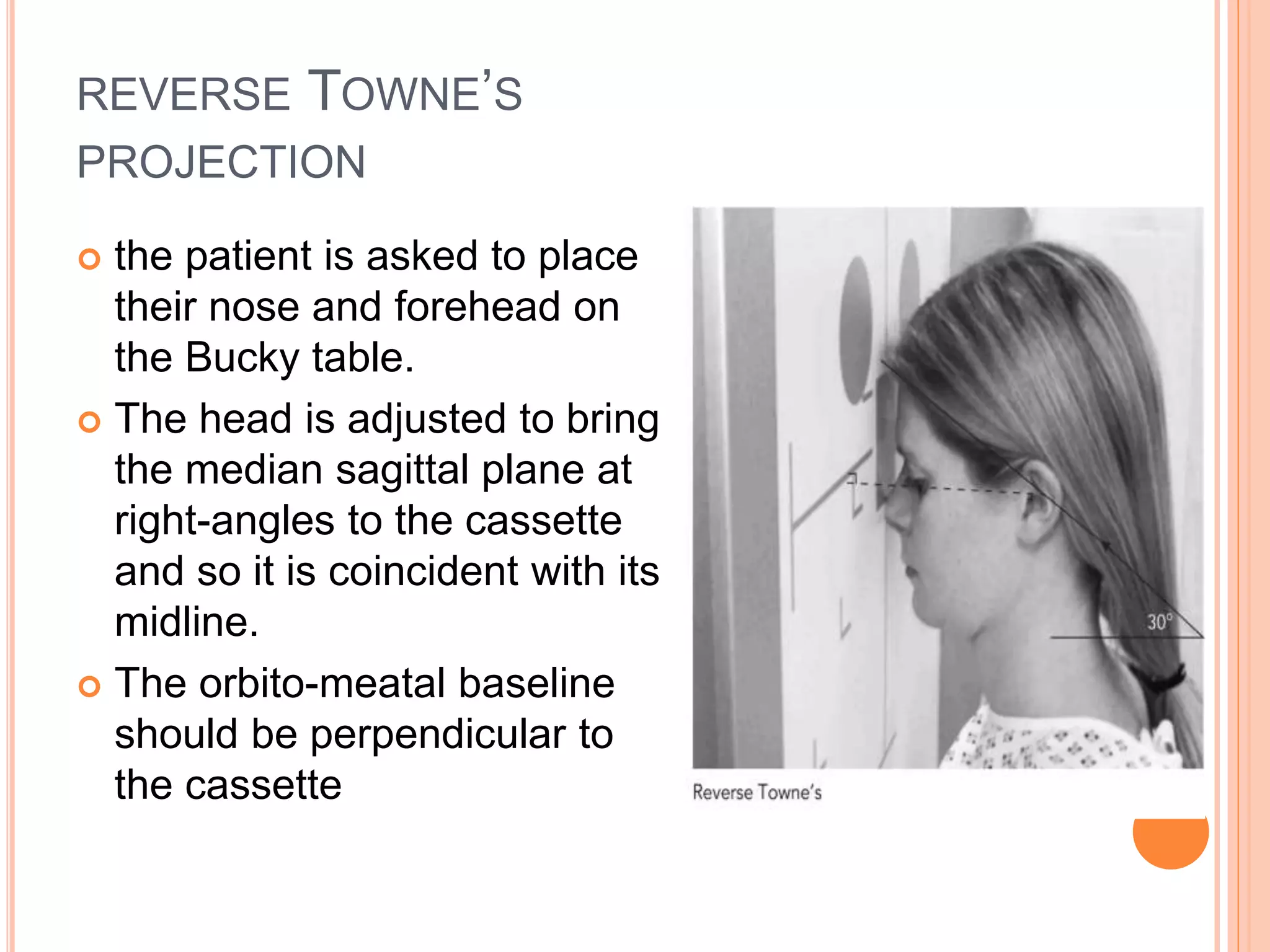 Xray views of skull1 | PPTX