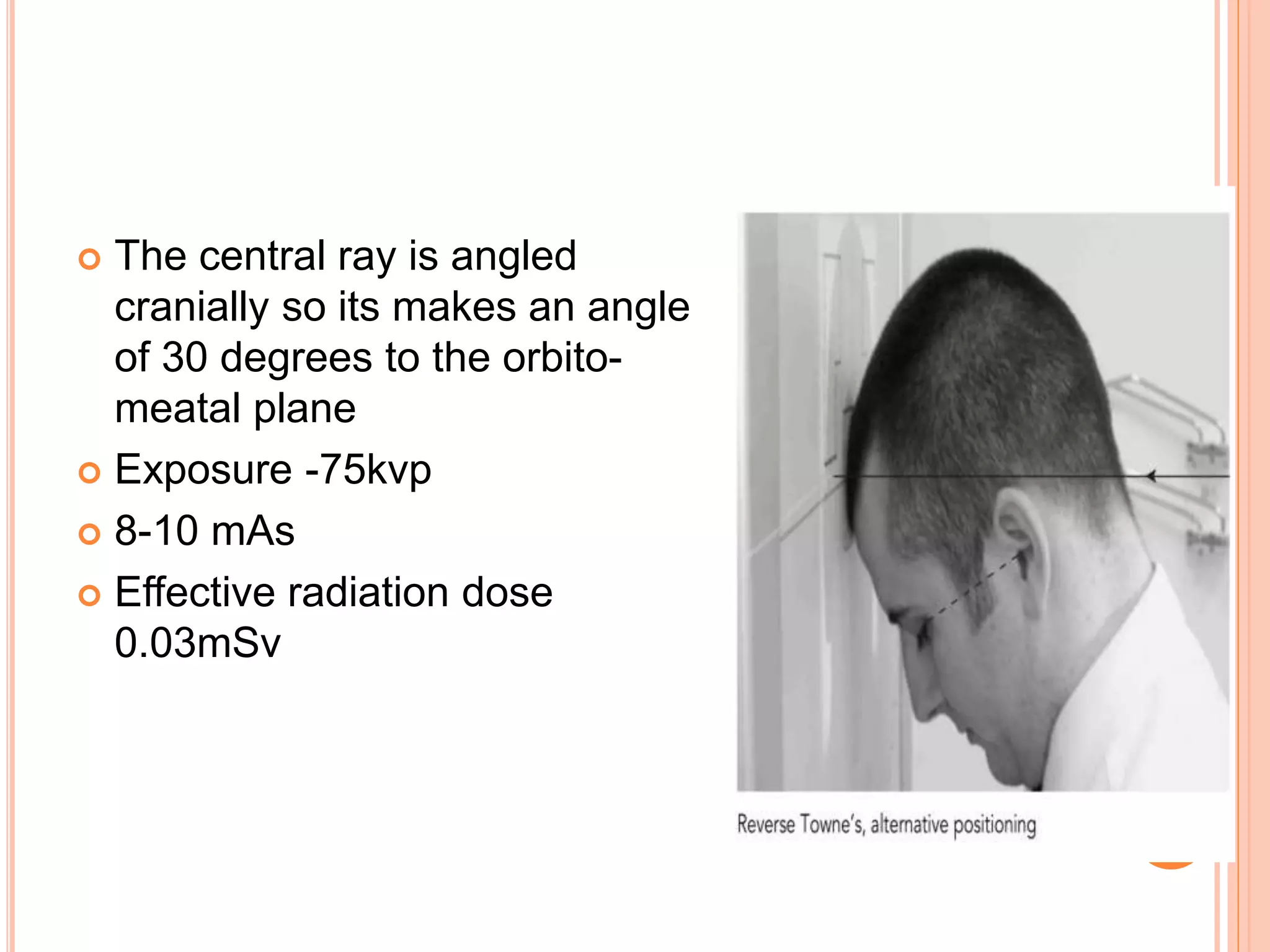 Xray views of skull1 | PPTX