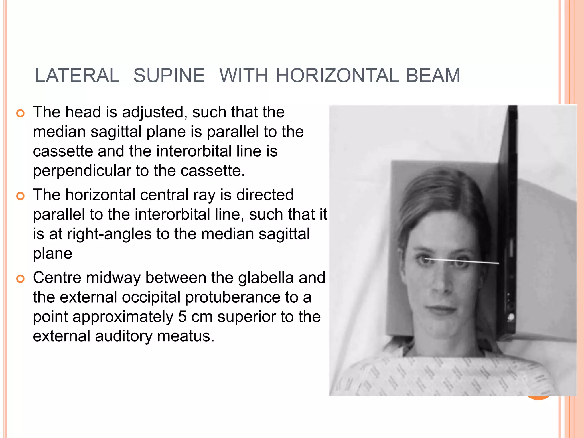 Xray views of skull1 | PPTX