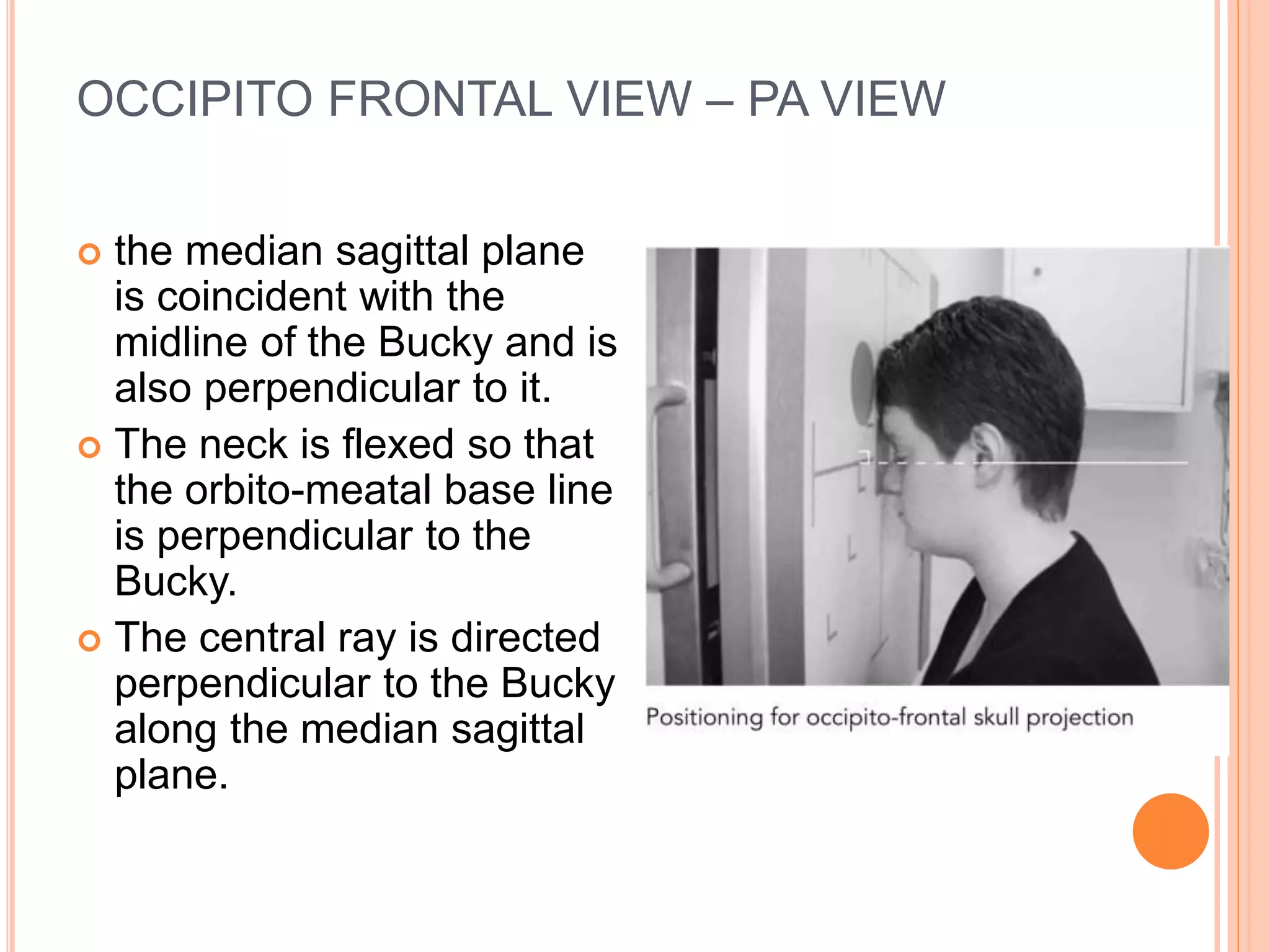 Xray views of skull1 | PPTX