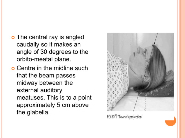 Xray views of skull1 | PPTX | Ear, Nose and Throat Conditions ...