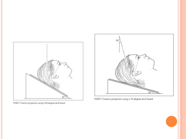 Xray views of skull1 | PPTX | Ear, Nose and Throat Conditions ...
