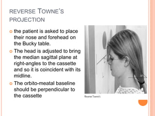 Xray views of skull1 | PPTX