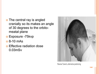 Xray views of skull1 | PPTX