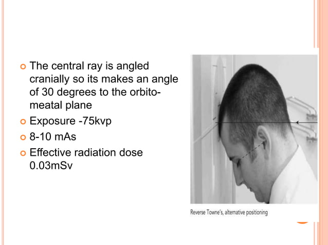 Xray views of skull1 | PPTX | Ear, Nose and Throat Conditions ...