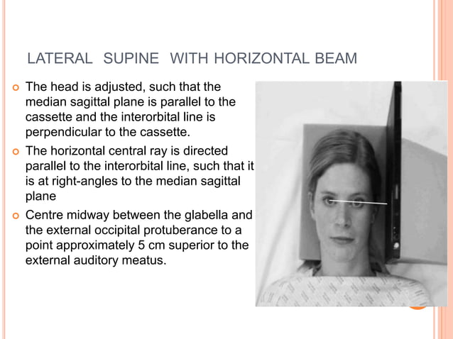Xray views of skull1 | PPTX | Ear, Nose and Throat Conditions ...