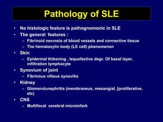 SYSTEMIC LUPUS ERITHEMATOSUS INTERACTIVE | PPT