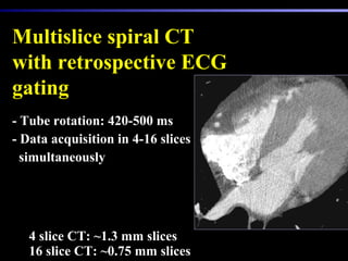 072 ct angiography | PPT