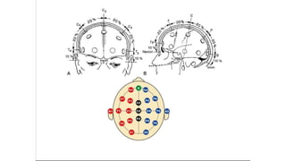 Xử trí co giật | PPTX