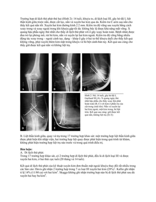 Xuyen kim mat ngoai khuyu bs huynh manh nhi | PDF