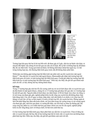 Xuyen kim mat ngoai khuyu bs huynh manh nhi | PDF