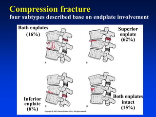 CHẤN THƯƠNG CỘT SỐNG | PPT