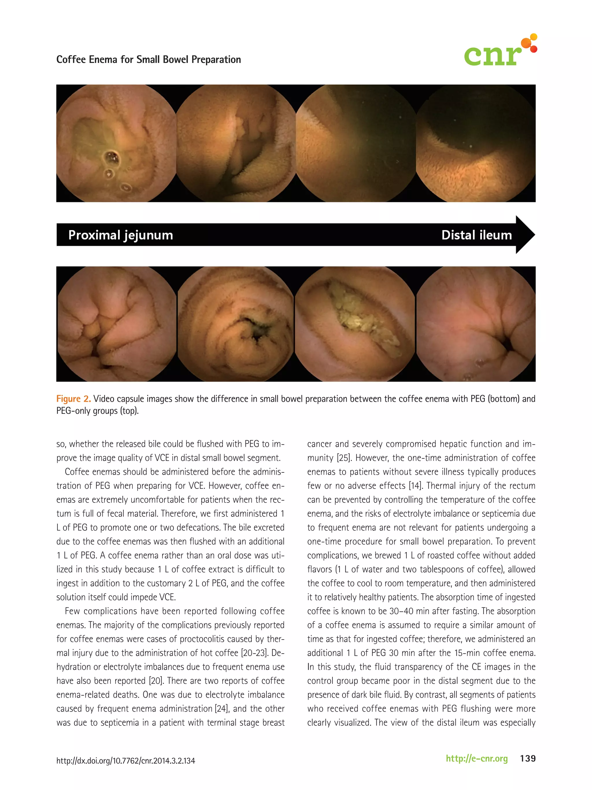 Coffee Enema for Preparation for Small Bowel Video Capsule Endoscop | PDF