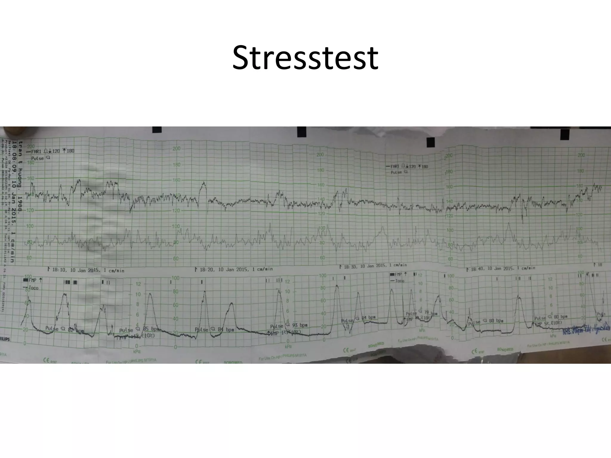 TÌNH HUỐNG LÂM SÀNG NONSTRESS TEST VÀ STRESS TEST | PPT