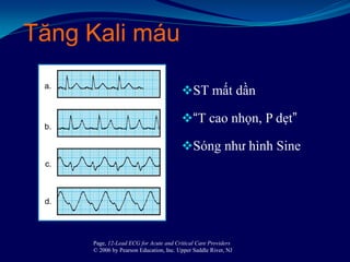 ĐIỆN TÂM ĐỒ TRONG RỐI LOẠN ĐIỆN GIẢI | PDF